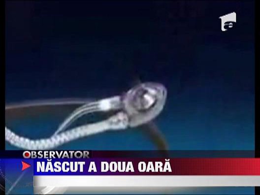 Primul roman cu inima artificiala | Observatornews.ro