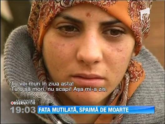Tanara din Teleorman mutilata pe viata din gelozie a fost externata ... Tanara din Teleorman mutilata pe viata din gelozie a fost externata ...