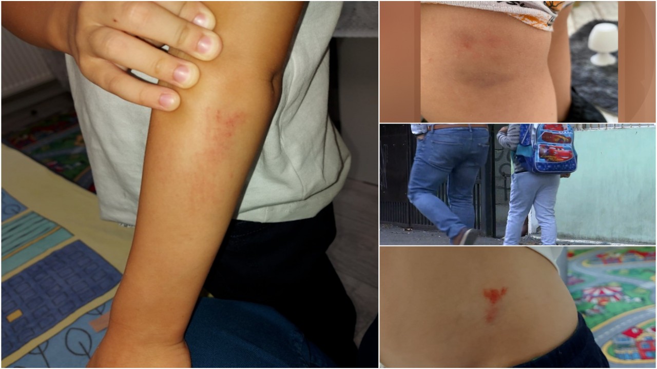 Caz uluitor la o şcoală din Braşov. Un elev de 7 ani îşi bate toţi ... Caz uluitor la o şcoală din Braşov. Un elev de 7 ani îşi bate toţi ...